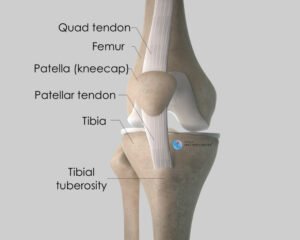 Anterior Tibial Tuberosity Transfer Patella Realignment - Doctor Matthieu Meyer