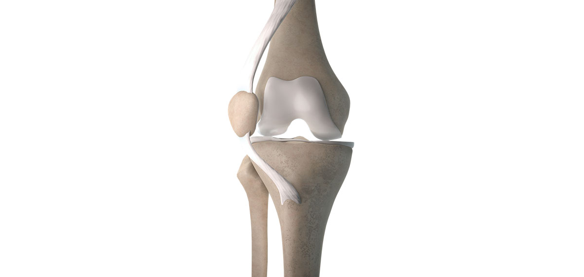 Patellar Instability Surgery - Doctor Matthieu Meyer