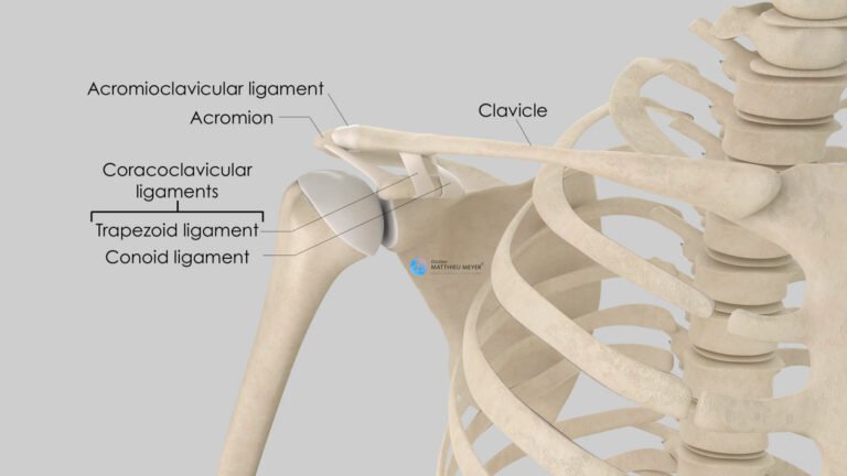 Acromioclavicular Dislocation - Doctor Matthieu Meyer